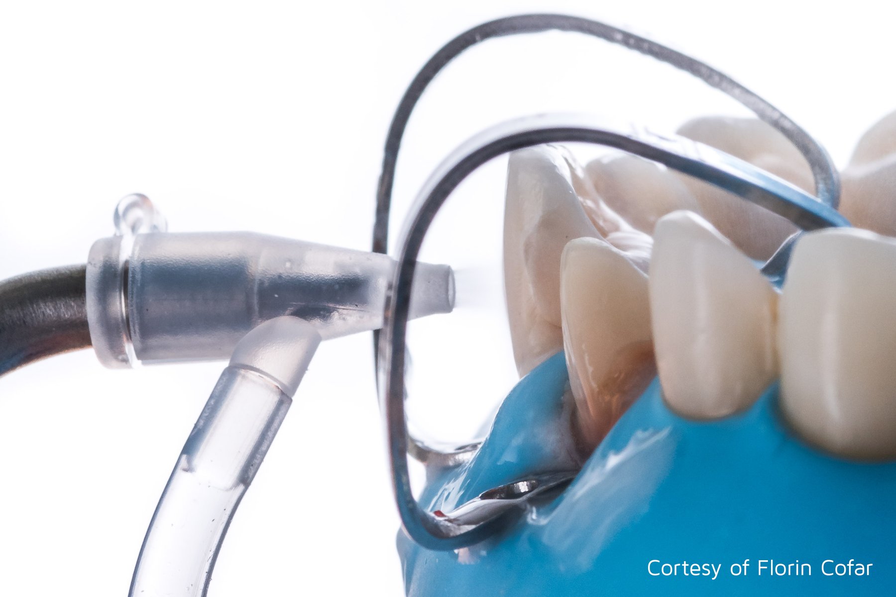 All You Need To Know About The AquaCare - Optident