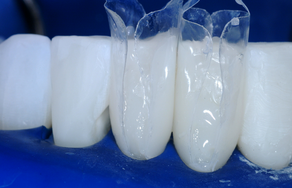 Why Dentists Need To Reimagine Restorative Dentistry - Optident