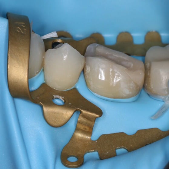 Back to work with the Optident Essentials - Optident