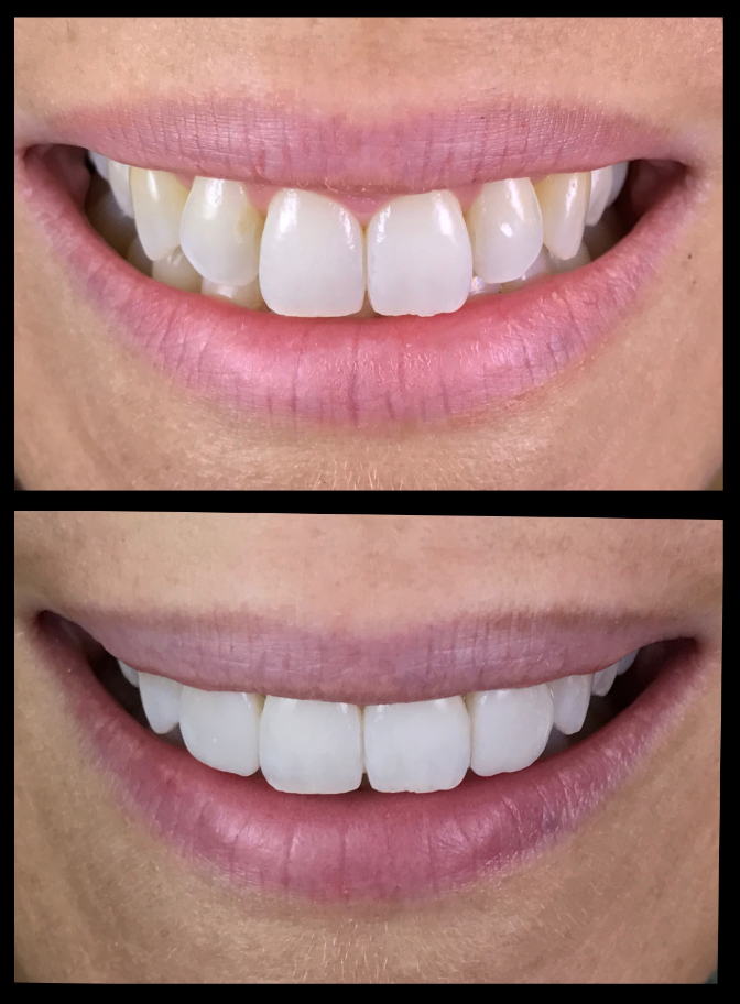 The Best Lighting for Shade Taking and Clinical Dental Photography ...