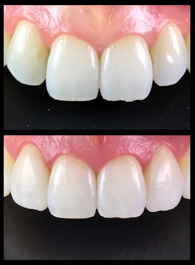 The Best Lighting for Shade Taking and Clinical Dental Photography ...