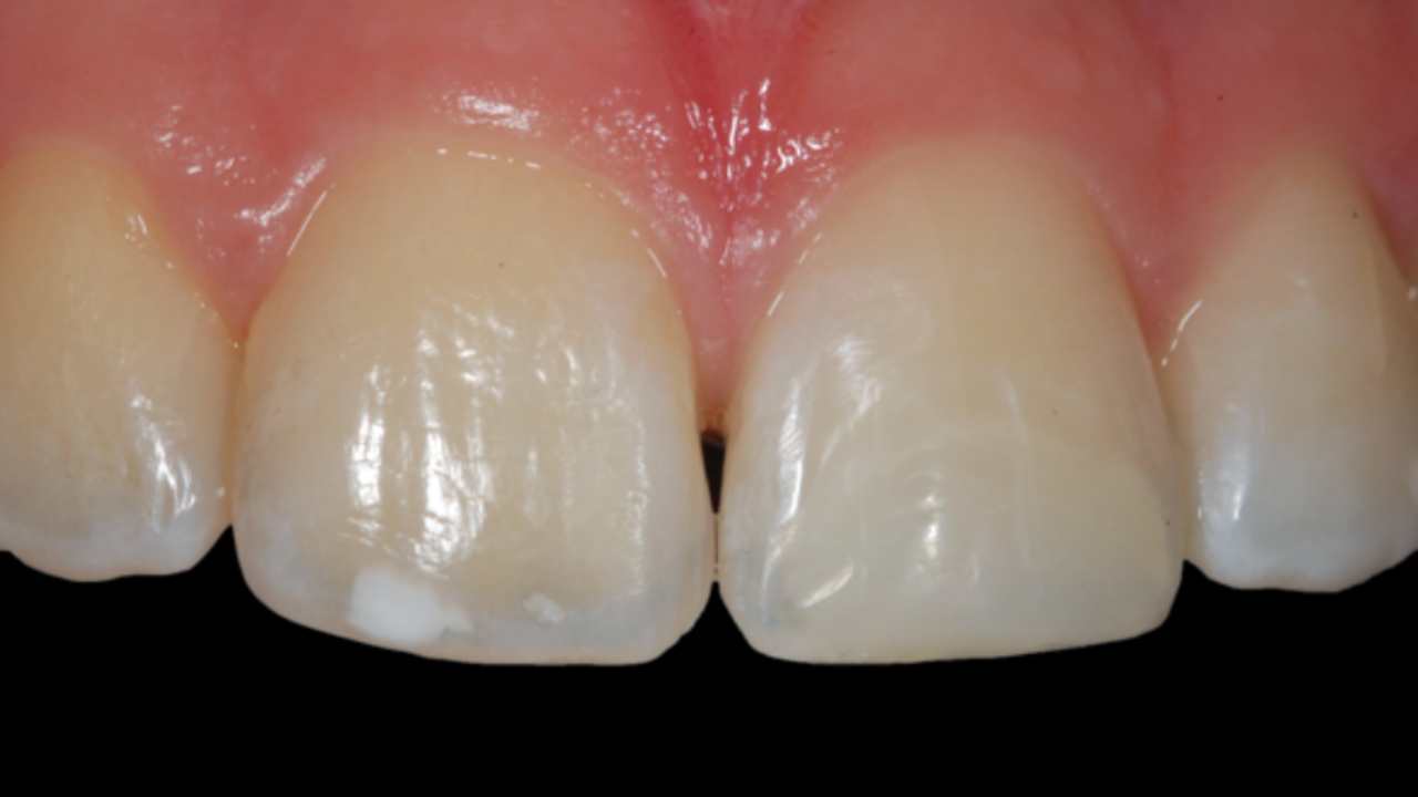 5 Essential Uses For The AquaCare - Optident