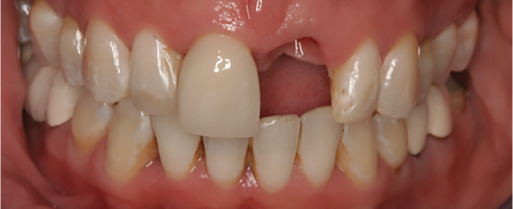 Home - Optident - Specialist Dental Supplies Online, Dentistry Courses ...