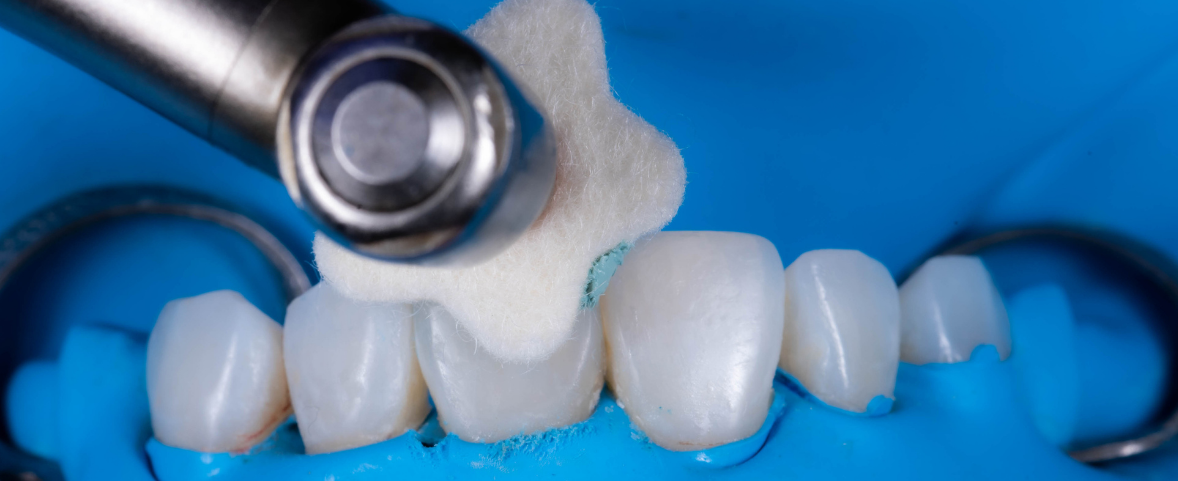 Home - Optident - Specialist Dental Products And Courses