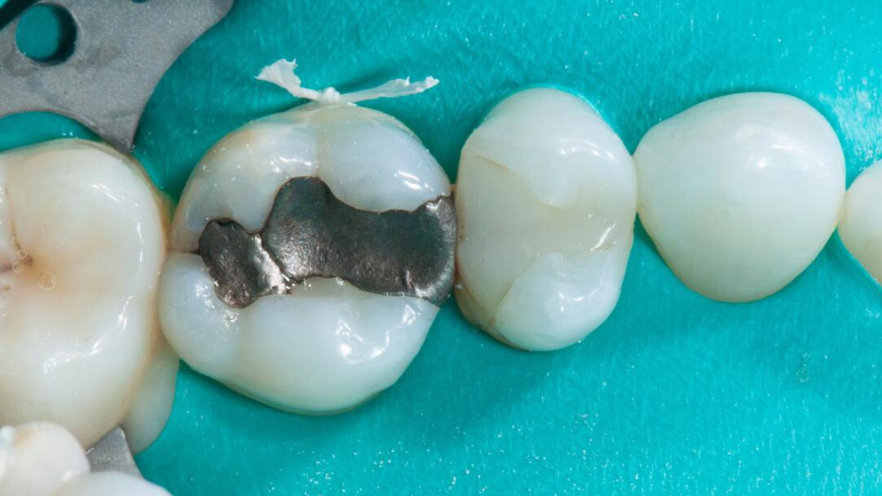 5 Essential Uses For The AquaCare - Optident