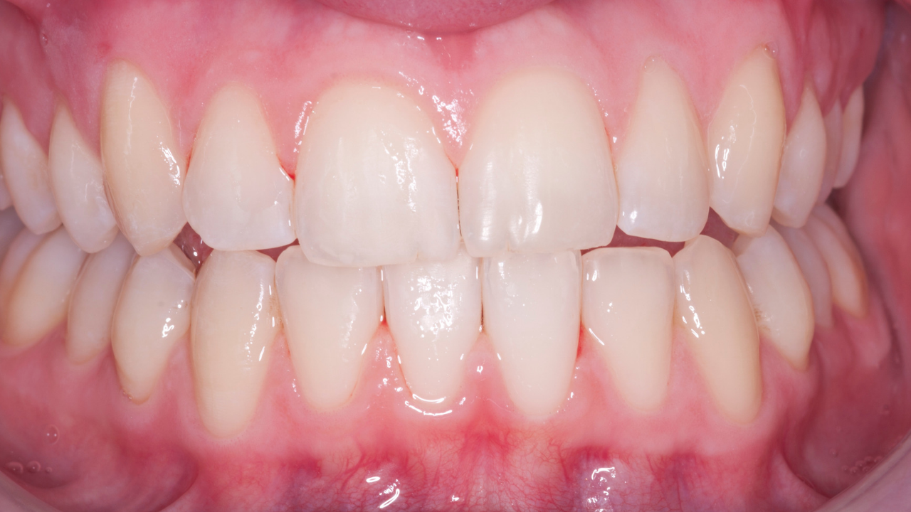 5 Essential Uses For The AquaCare - Optident